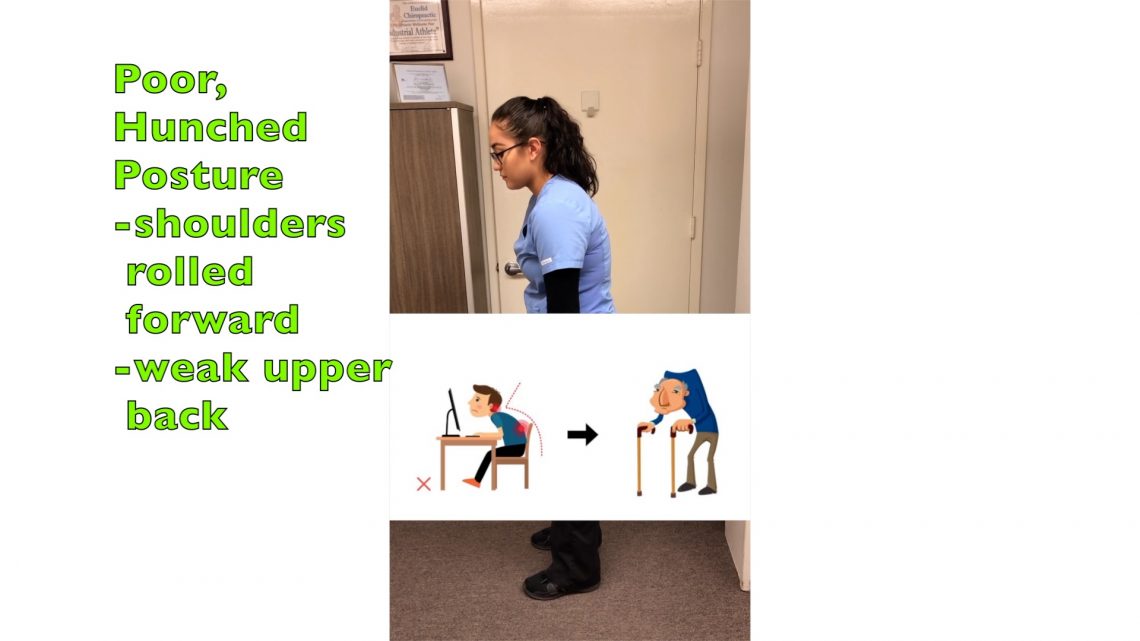 Corner Stretch to Fix Forward Rounded Shoulders by this Exercise by ...
